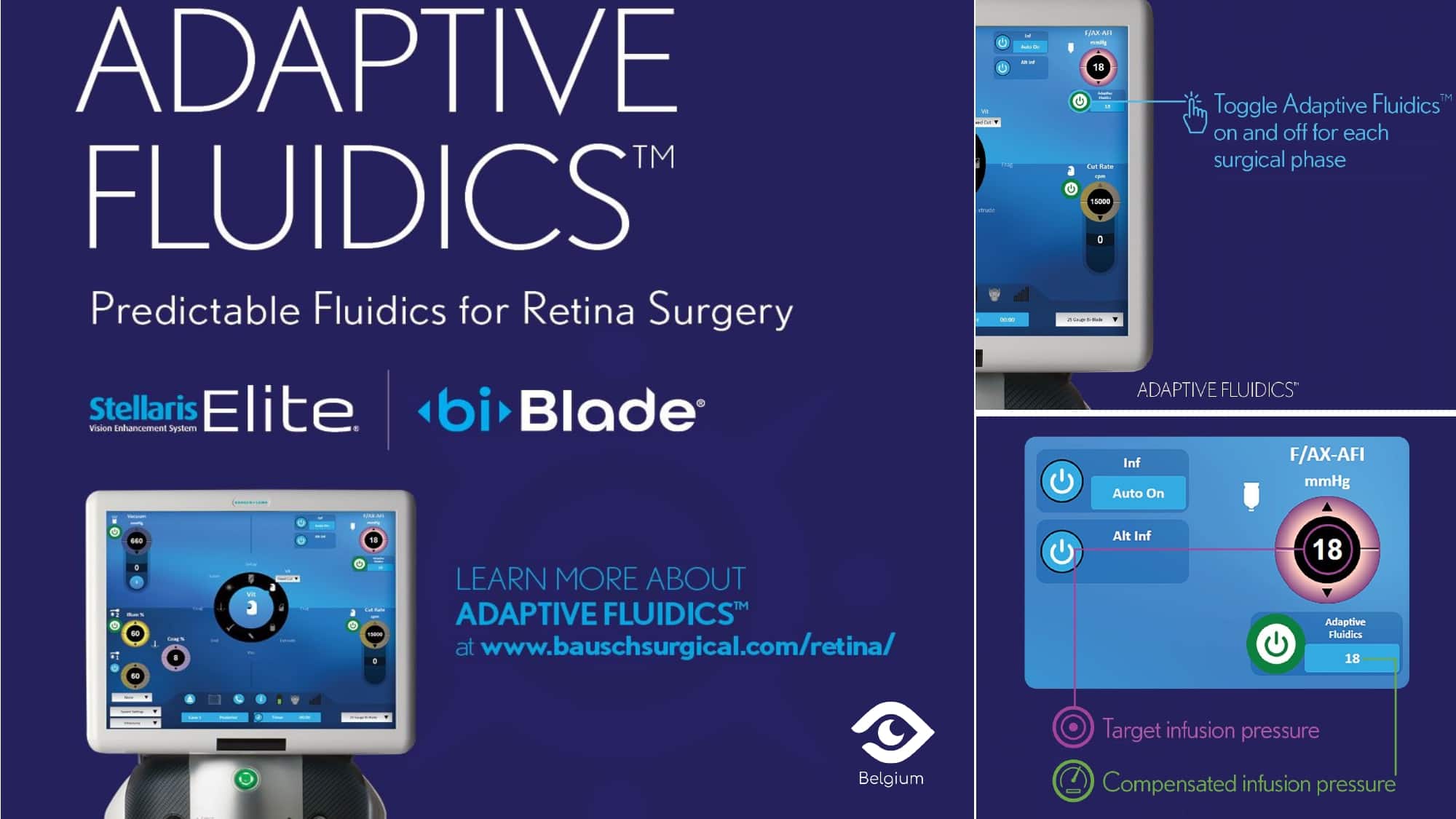 Stellaris Elite with Adaptive Fluidics Advanced Eye Surgery System